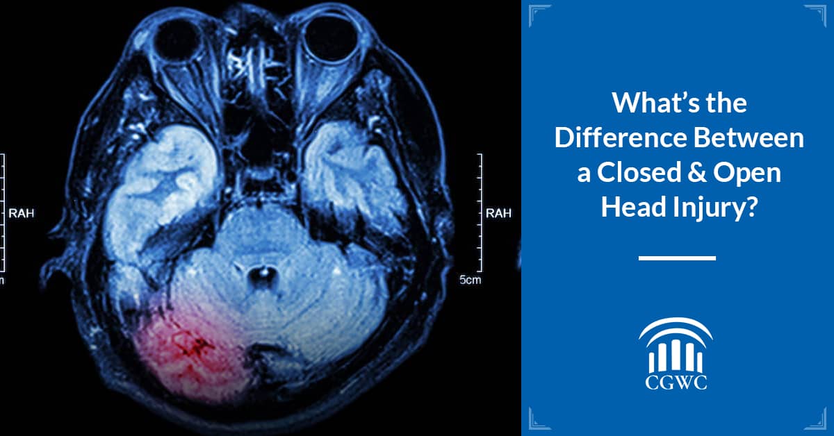 Open Head Injury vs. Closed Head Injury: What Is The Difference?